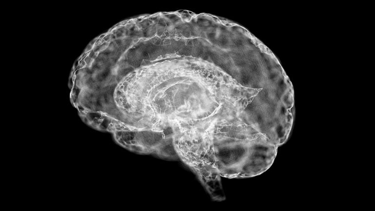 A Possible Mechanism Behind Brain Fog - FrontlineER Dallas